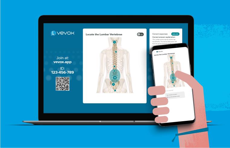 Open text polling with Vevox